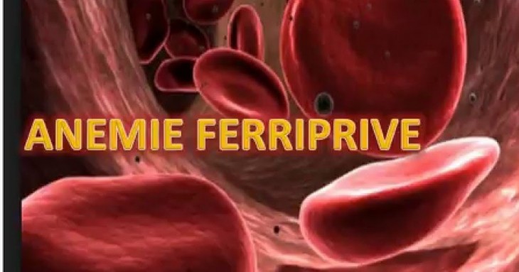Anémie ferriprive - Actualités - Sante-dz