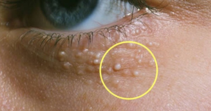 Les grains de milium - Actualités - Sante-dz