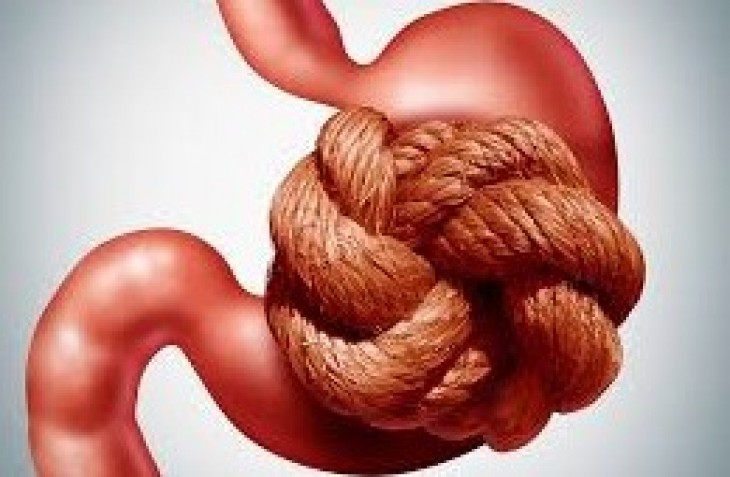 Hygiène de vie pour améliorer son transit intestinal - Conseils - Sante-dz